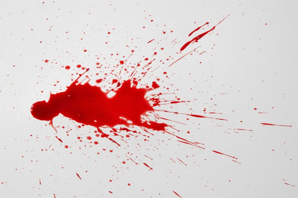 Black box study assesses the Accuracy and Reproducibility of Bloodstain ...